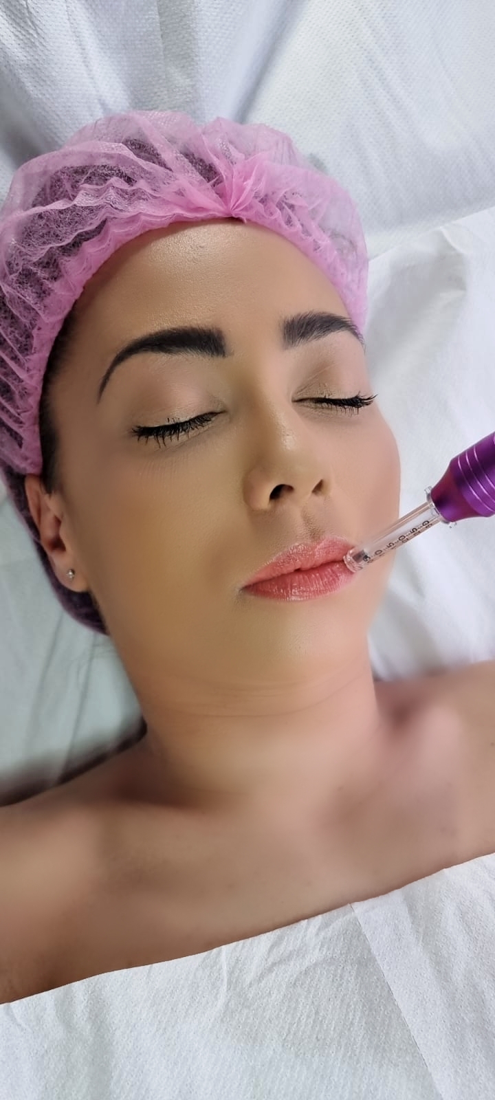 No needle lip fillers - The Country Salon & Aesthetics